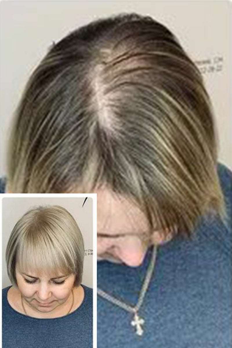 Premium Hair Loss Solutions with High-Quality Human Hair – SEULLY