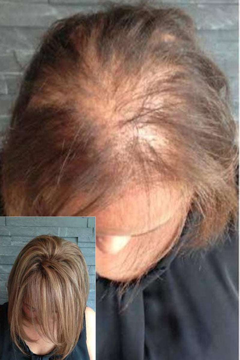 Premium Hair Loss Solutions with High-Quality Human Hair – SEULLY