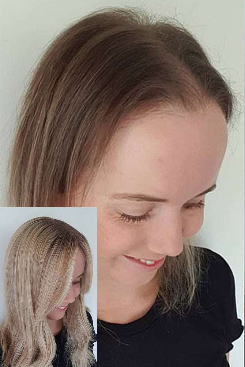 Premium Hair Loss Solutions with High-Quality Human Hair – SEULLY